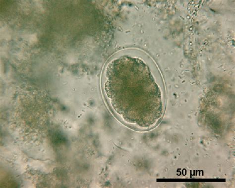 Microscopic Image Of A Hookworm Egg Under 500x Magnification Scale Bar Download Scientific