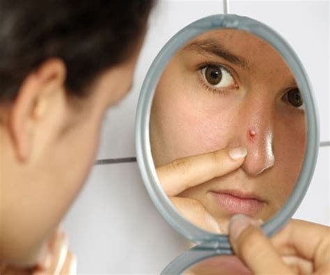 Tips To Prevent Pimples And Causes Of Pimples Big Fun The Fun Blog