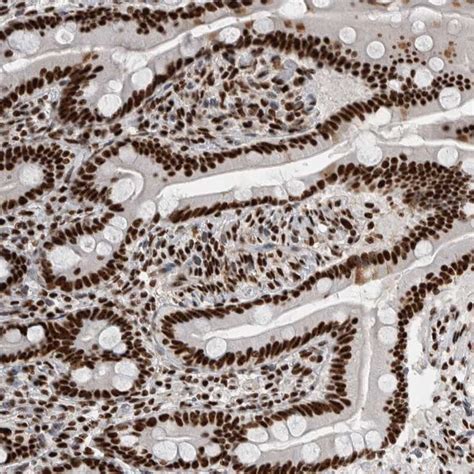 Nucleolin Antibody Pa5 82860