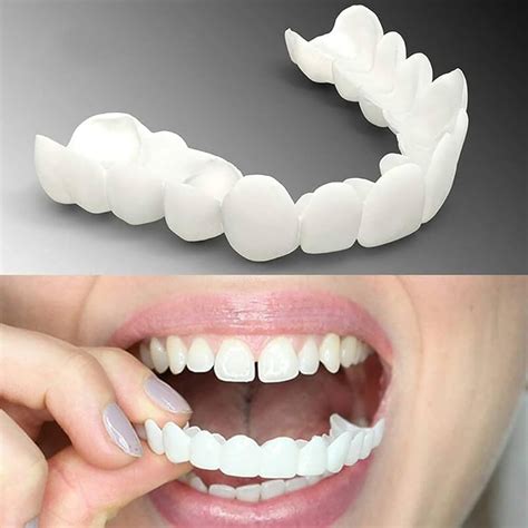 Wttfc Clip On Teeth 2 Pairs Of Fake Teeth Perfect Smile Veneers Snap