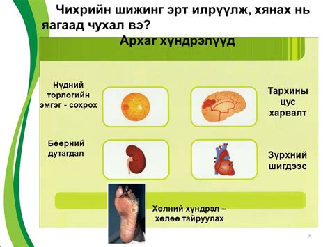 1 Чихрийн шижин Эрүүл мэндийн газар НЭМХ ийн дарга Д Алтантуяа Ppt Download