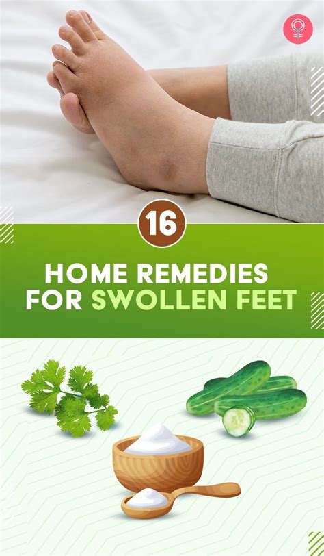 17 Home Remedies For Swollen Feet Symptoms And Treatments Artofit