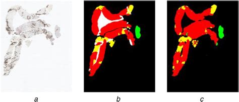 example of cd‐unet segmentation output of a ki67 cd3 image from the