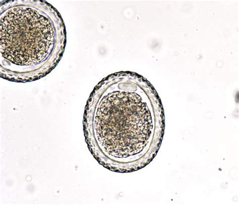 Nematode Introduction Flashcards Quizlet