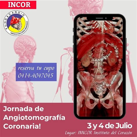 Incor Fundacardio Incor