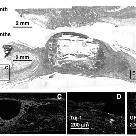 Control Defect No Scaffold Implant At 1 And 3 Months Hande Stained And