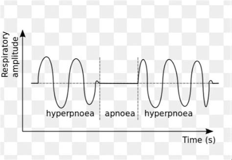 Abnormal Breathing Patterns Pics Flashcards Quizlet
