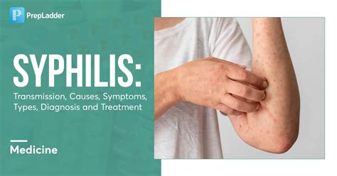 Syphilis Transmission Causes Symptoms Types And Diagnosis