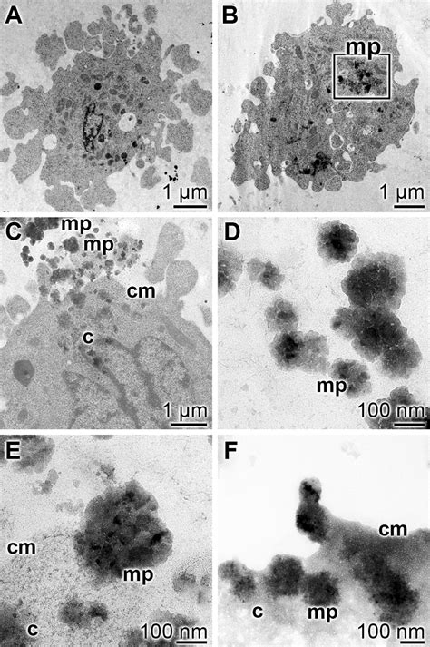 Uptake Of Microparticles Ca Polyp Mp By Saos 2 Cells Tem The