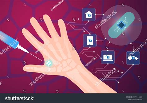 Human Microchip Implant Hand Nfc Implant Stock Vector Royalty Free 1179944626 Shutterstock