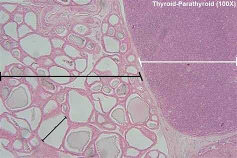 Parathyroid Microscope Slide