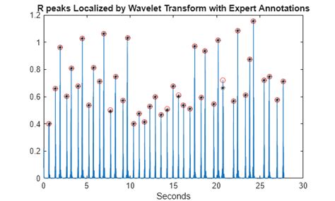 Wavelet Analysis Of Physiologic Signals MATLAB Simulink Example