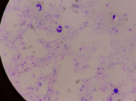 Lacuna Malaria Detection Object Detection Dataset By Research