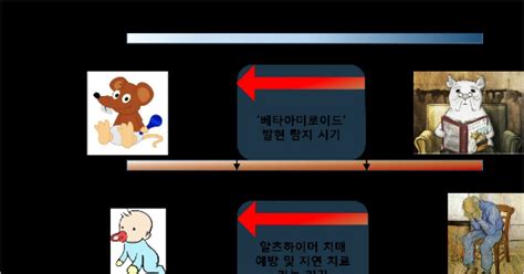 알츠하이머성 치매 조기 진단의 새로운 길 열어