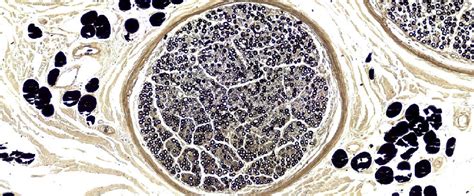 Nervous Tissue Peripheral Nerve Slide Prepared Slides