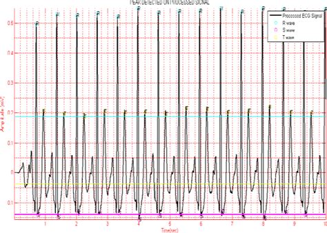 Figure From MATLAB Based ECG Signal Classification Semantic Scholar