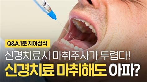 치과 신경치료 마취해도 통증이 마취주사 맞아도 아프다고 Youtube