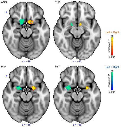 Piriform Cortex Anatomy