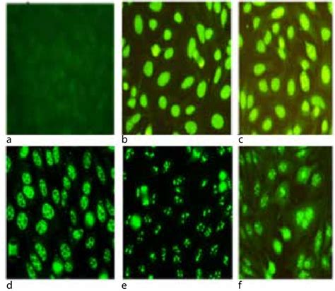 Common Ana Patterns By Iif A Negative Sample B Homogeneous C Download Scientific Diagram