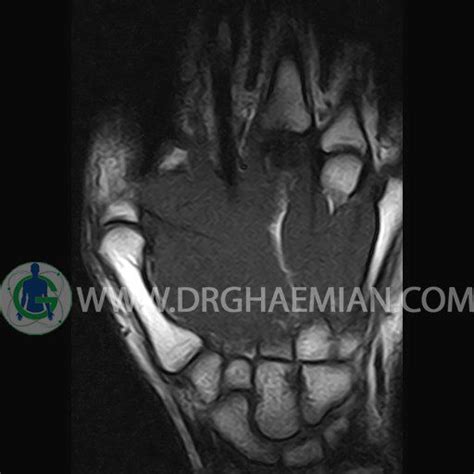 ام آر آی بازو چیست و چرا استفاده می شود؟ مرکز تصویربرداری پزشکی دکتر