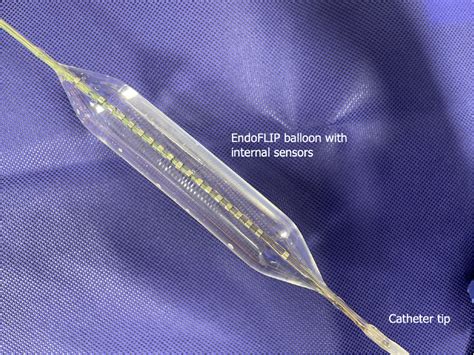 Endolumenal Functional Lumen Imaging Probe Catheter Filled Endoflip Download Scientific
