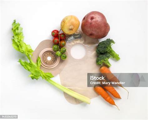 플랜지를 포함한 두 조각의 삼투압 기기 야채가있는 파우치 장루술에 대한 스톡 사진 및 기타 이미지 장루술 가방 건강관리와 의술 Istock