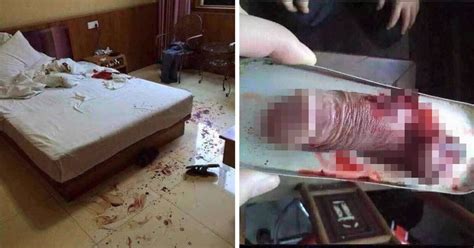 Cut Off His Penis Gala Porn Tube