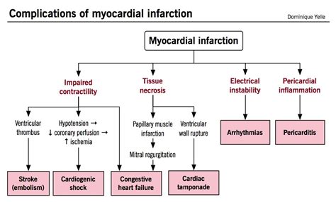Myocardial Infarction Cardiovascular Medbullets Step 1