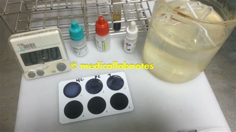 RF Test Introduction Principle Testing Procedure Result Interpret