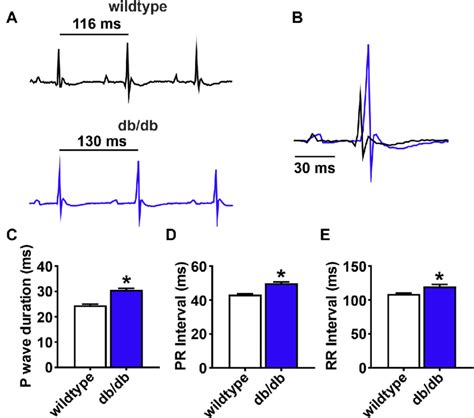 electrocardiographic ecg analysis in db db mice a representative