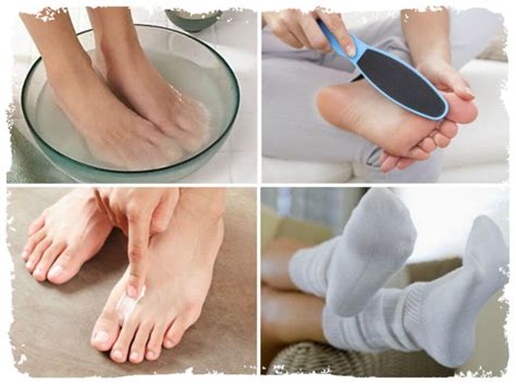 Как ухаживать за ногами Статейный Клуб АПП