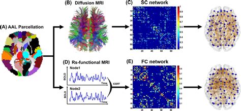 A Brief Introduction To Functional Connectomics By Mikey Taylor The