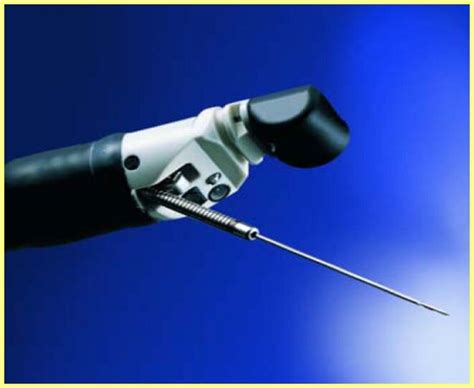 Distal End Of The Eus Scope With Permission From Olympus Tokyo Japan