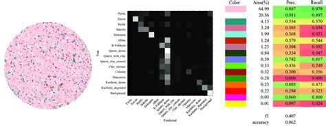 The Result Of The 3 Slice U Net Segmentation Approach Designations