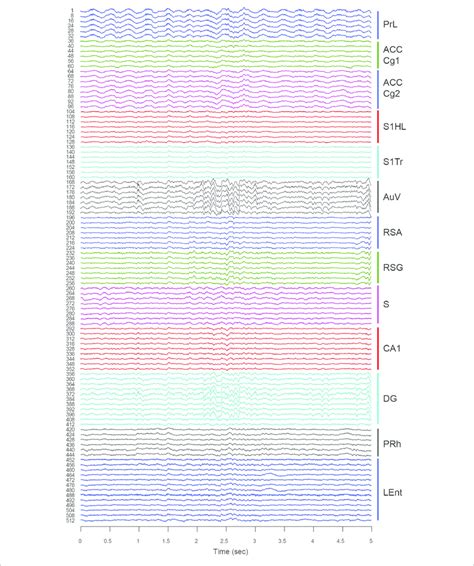 Large Scale Local Field Potentials Lfp Simultaneously Recorded From Download Scientific