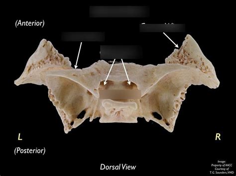 Sphenoid Bone Diagram Quizlet