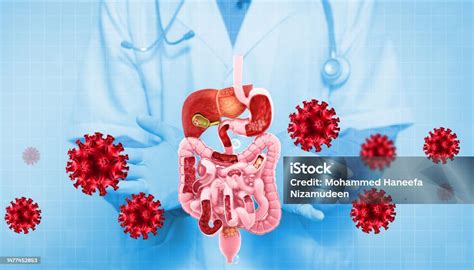 바이러스와 박테리아에 의해 감염 된 인간의 소화 시스템 소화관 또는 알리멘탈카나 3d 일러스트레이션 결장에 대한 스톡 사진 및 기타 이미지 Istock