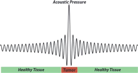 Figure 2 From A Space Time Discontinuous Galerkin Method For Linear Hyperbolic Pdes With High