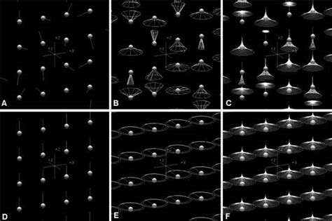 Basics Of Magnetic Resonance Imaging Barrow Neurological Institute