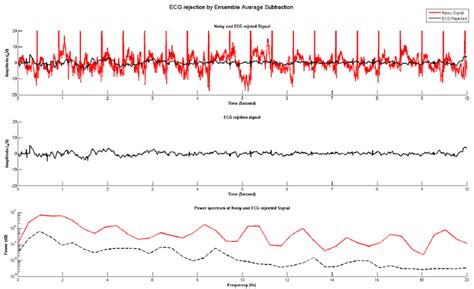 2 The Ecg Elimination By Using Wavelet Denoising Method Download Scientific Diagram