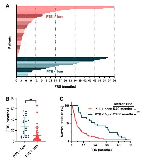 对高级别胶质瘤瘤周水肿的量化分析与生存模式的相关性研究 脑医汇