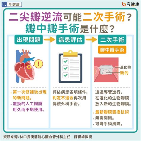 二尖瓣逆流恐要命，及早治療很重要！常見qanda一次看今健康 陳紹緯醫師