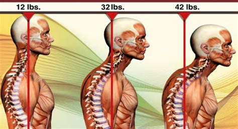 Fix Your Stiff Neck And Understand Cervical Spine Anatomy