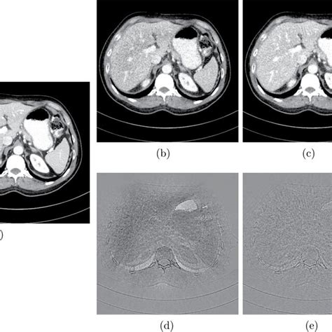 Reconstructions And Difference Images From Simulations Of Ct Download Scientific Diagram