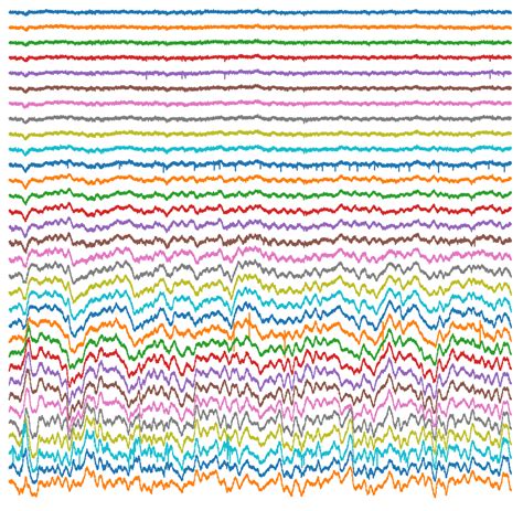 Multi Electrode Array Recording Soltesz Lab