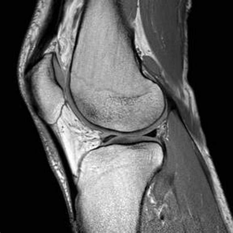 Advanced Msk Radiology Treatment In Aurangabad