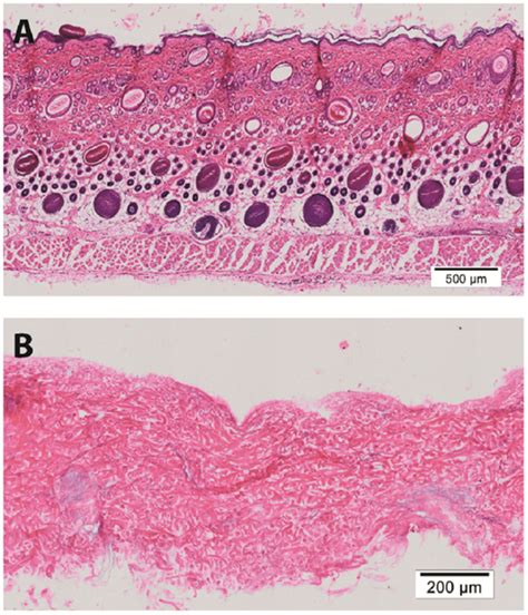 Frontiers Chondrogenesis Of Human Infrapatellar Fat Pad Stem Cells On Acellular Dermal Matrix