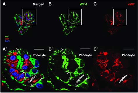 Podocyte Identification A A Representative Confocal Image Of A Download Scientific Diagram