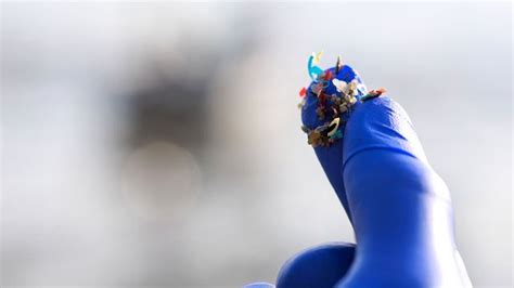 High Levels Of Microplastics Found In Human Brains Technology Networks