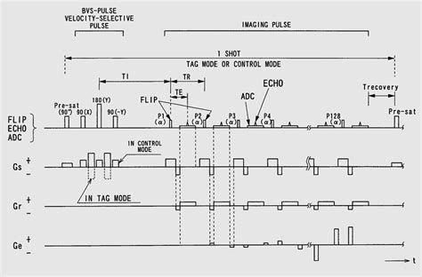 Mri Apparatus And Asl Imaging Technique Pioneering Minds